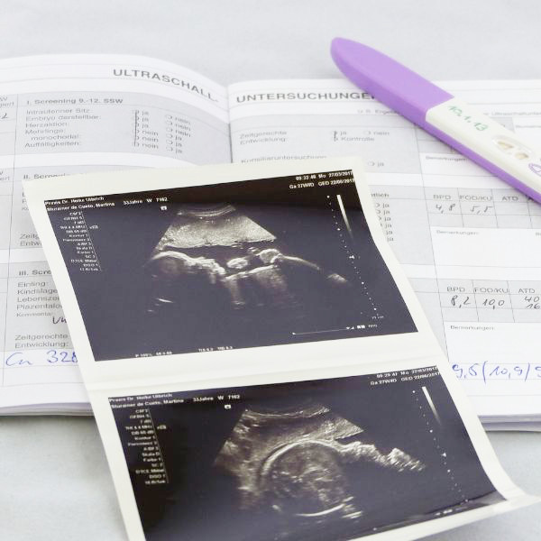 Der Mutterpass einfach erklärt: Chlamydia, HBs, Titer | nichtnurmama.de